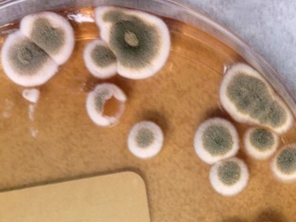 Aspergillus Versicolor Morphology